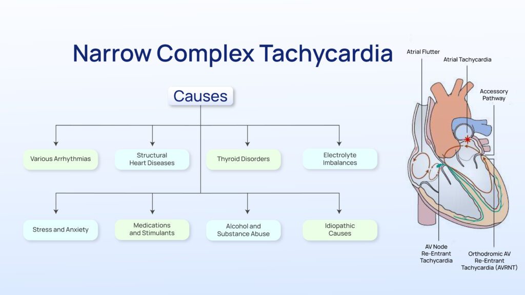 What is Narrow Complex Tachycardia? - Sunfox Technologies