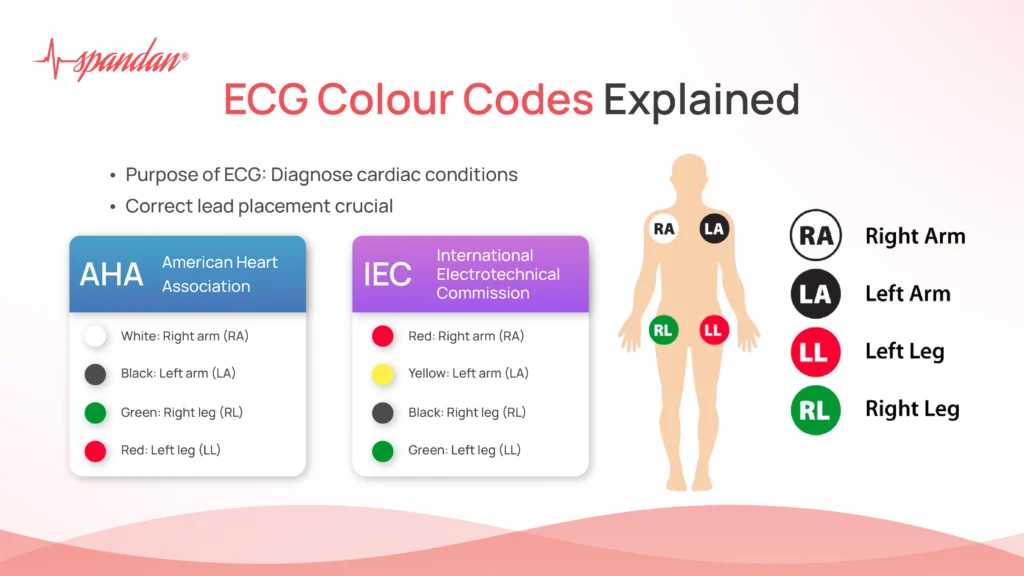ECG Colour Codes Explained ECG Colour Codes Explained