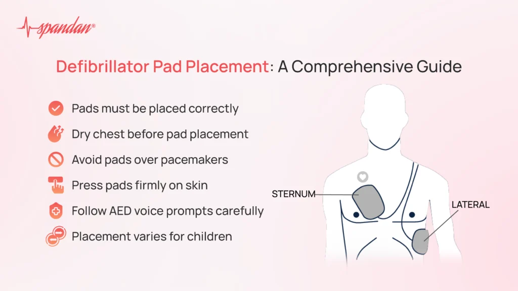 Defibrillator Pad Placement A Comprehensive Guide